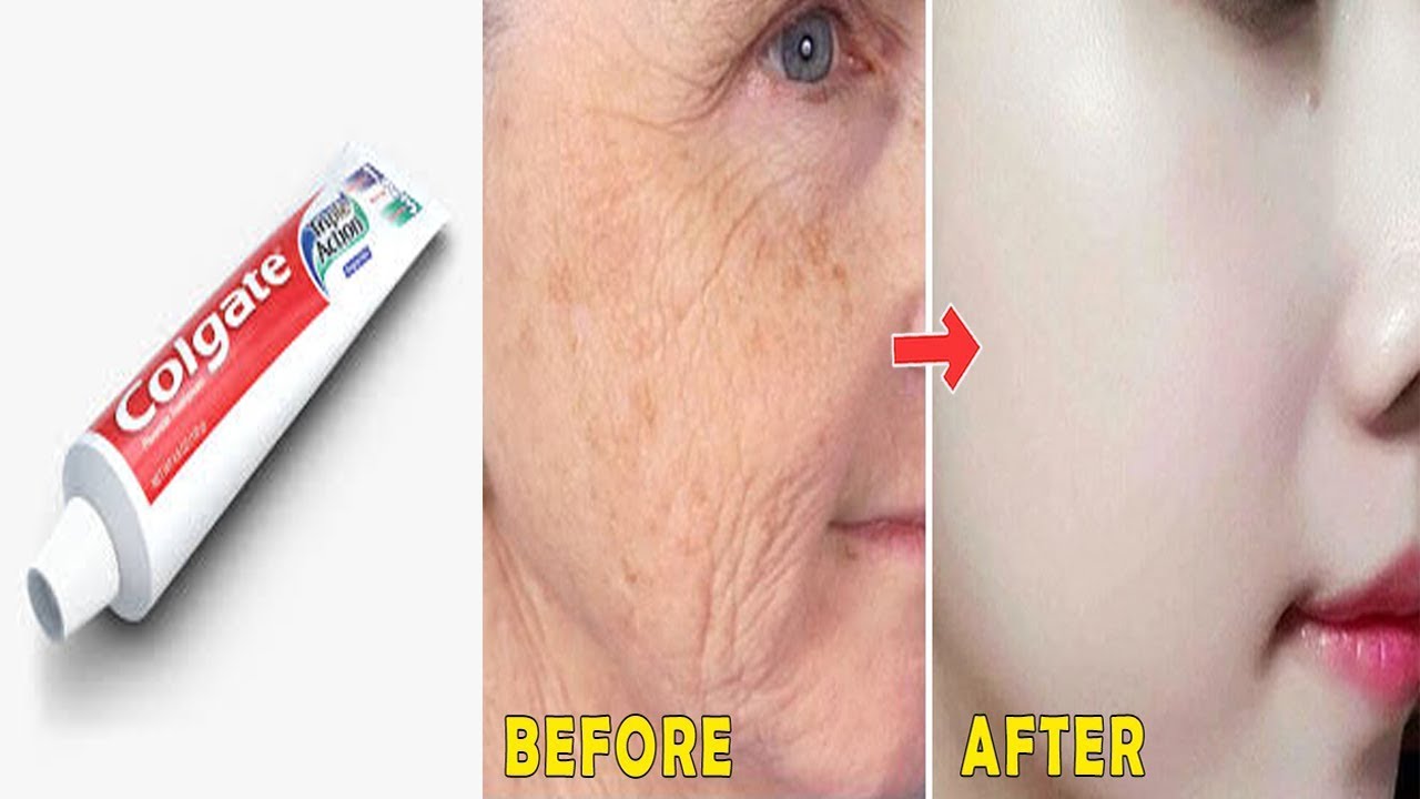 Apply Toothpaste On My Skin and Remove Wrinkles Forever - YouTube