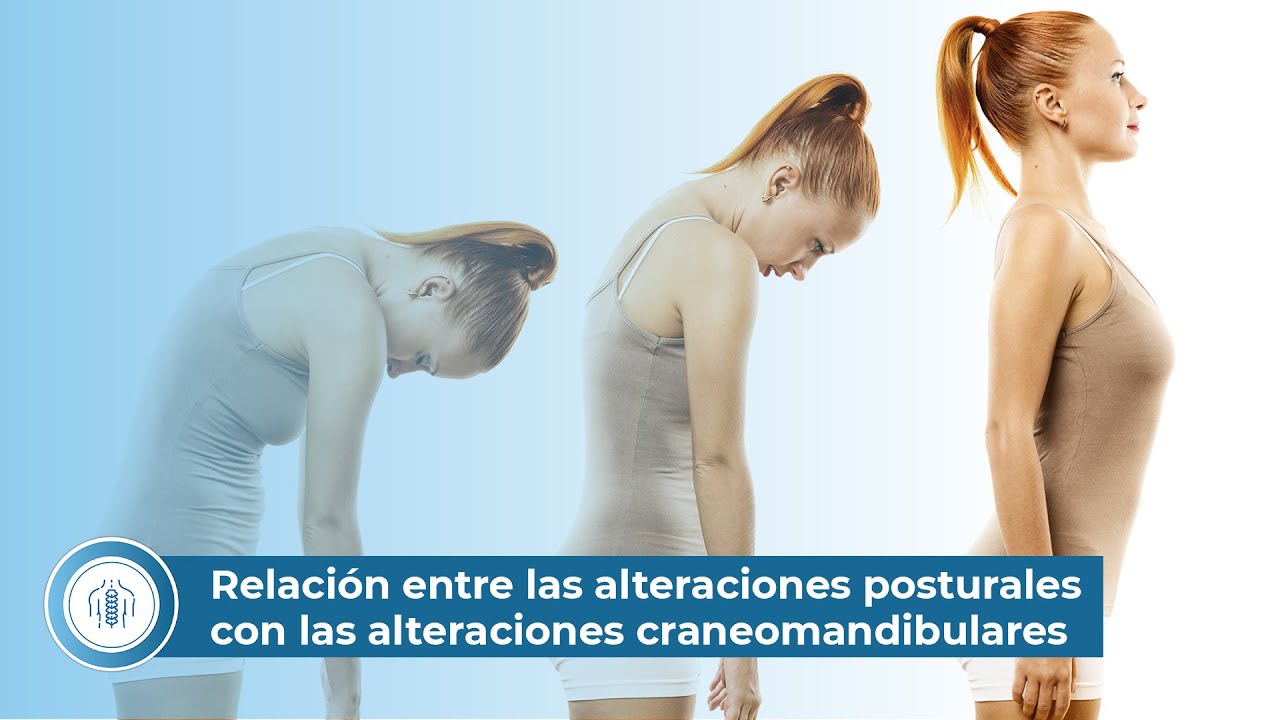 Webinar: postura, terapia manual, alteraciones posturales y ...