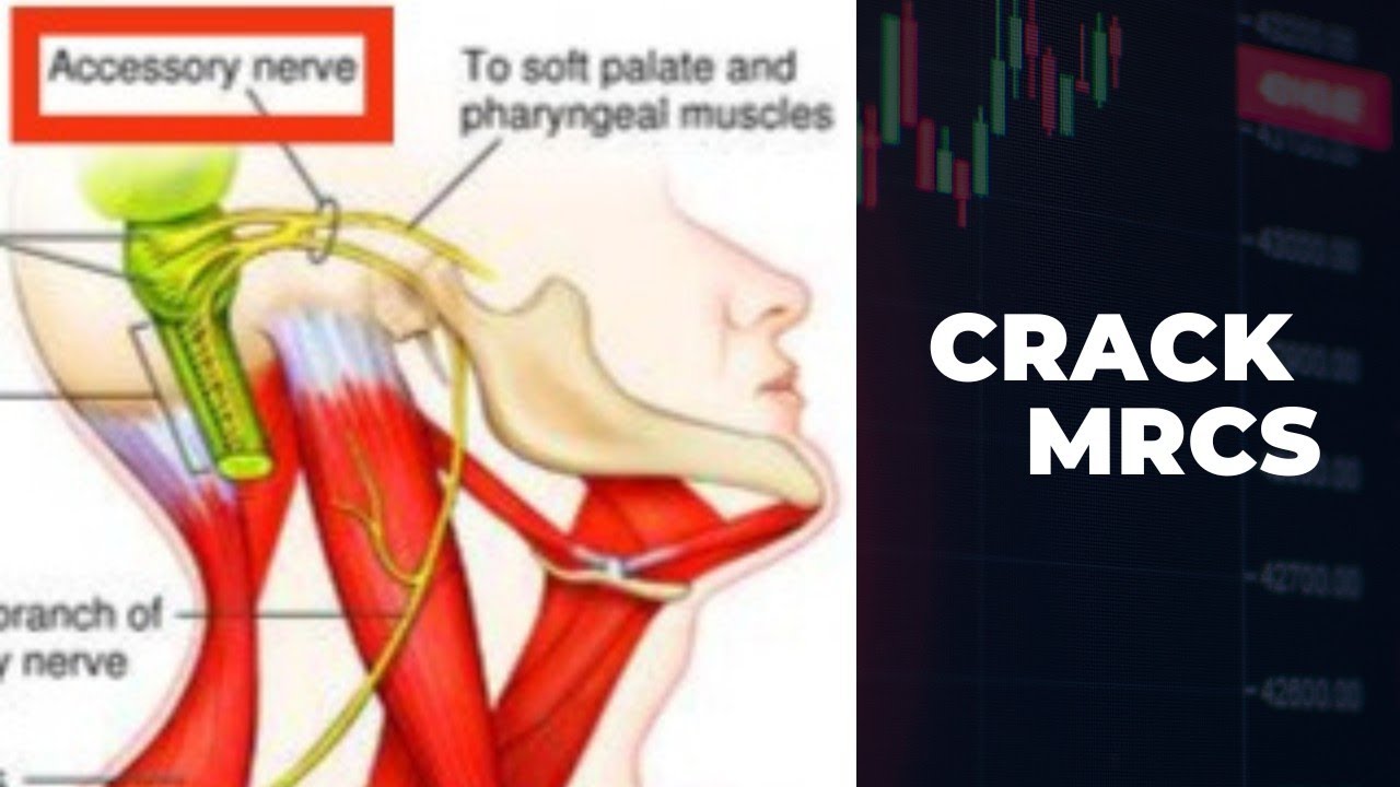 Spinal accessory nerve MRCS question solve - YouTube