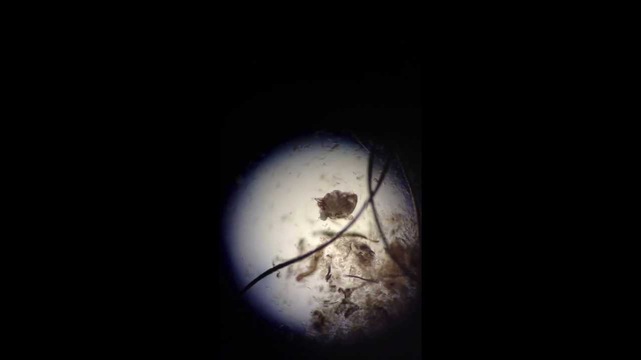 Sarcoptic Mange Mite under the microscope - YouTube