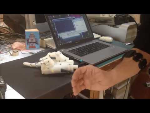 InMoov 2 Hand + Myo Thalmic first control 3D printed prosthesis - YouTube