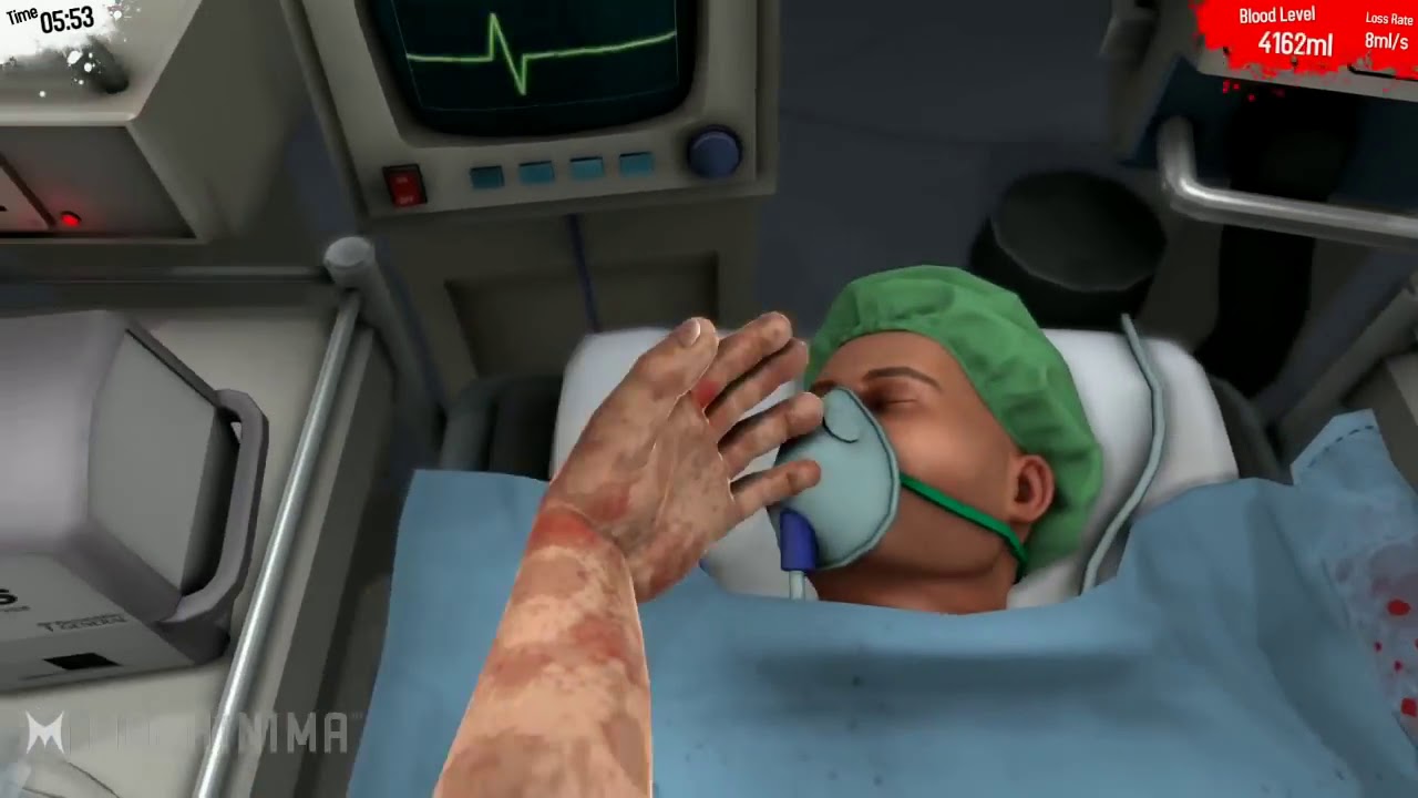 Episode 2 - Surgeon Simulator 2013 Kidney Game Play! - YouTube