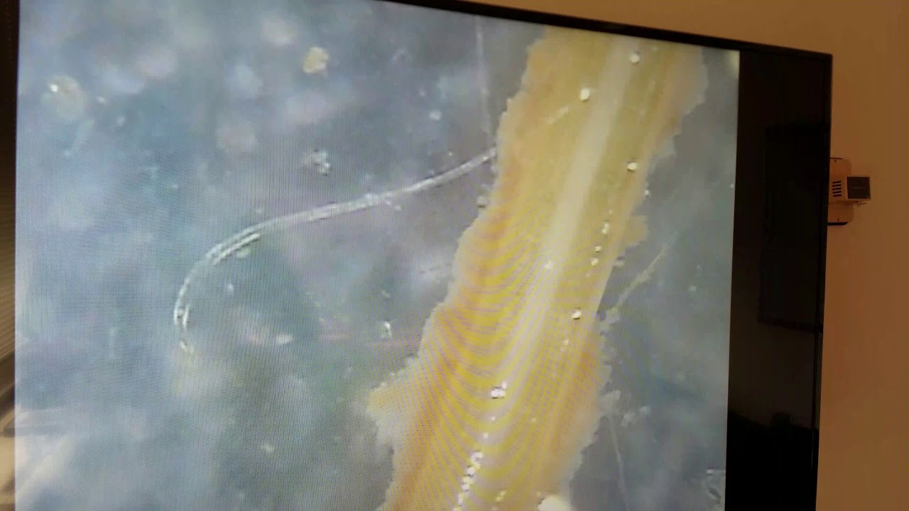 Hay infusion microbes on a cheap digital microscope - YouTube