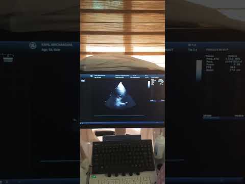 2D Echo Machine - YouTube