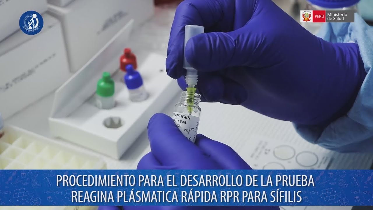 Desarrollo de la prueba Reagina Plásmatica Rápida (RPR) para el ...