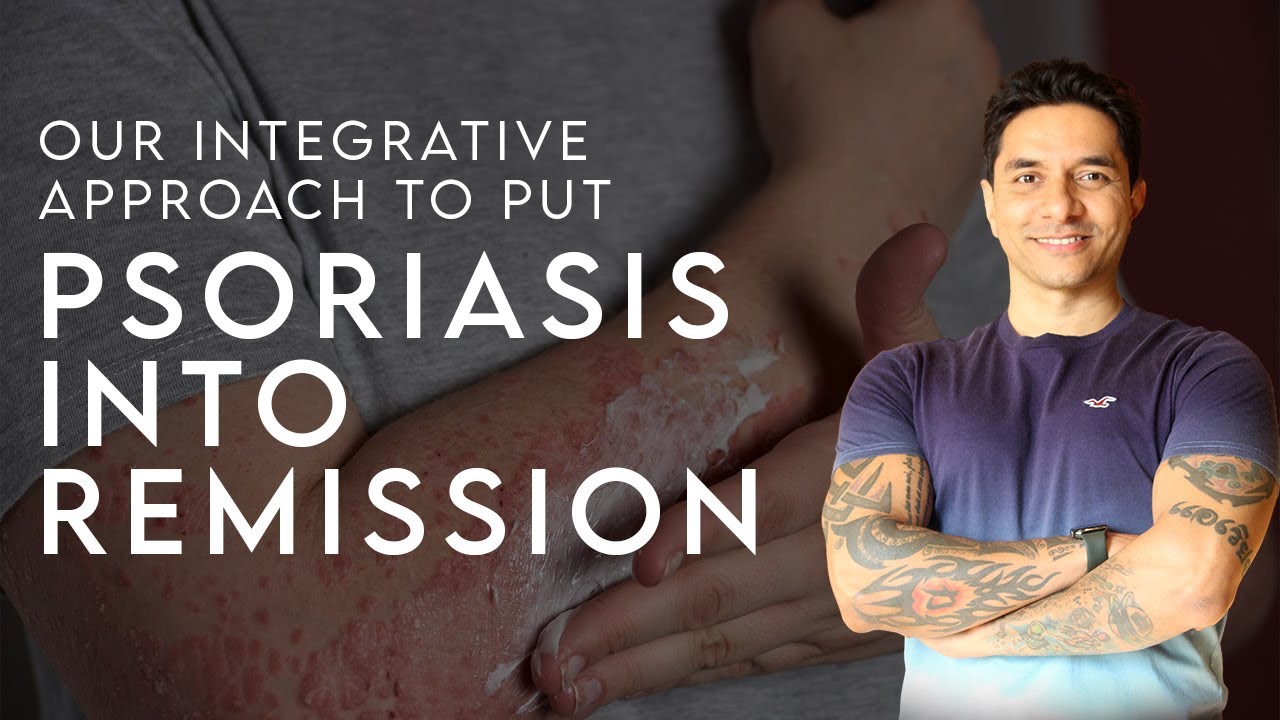 From Struggle to Strength: Why We See Success With Handling Psoriasis ...