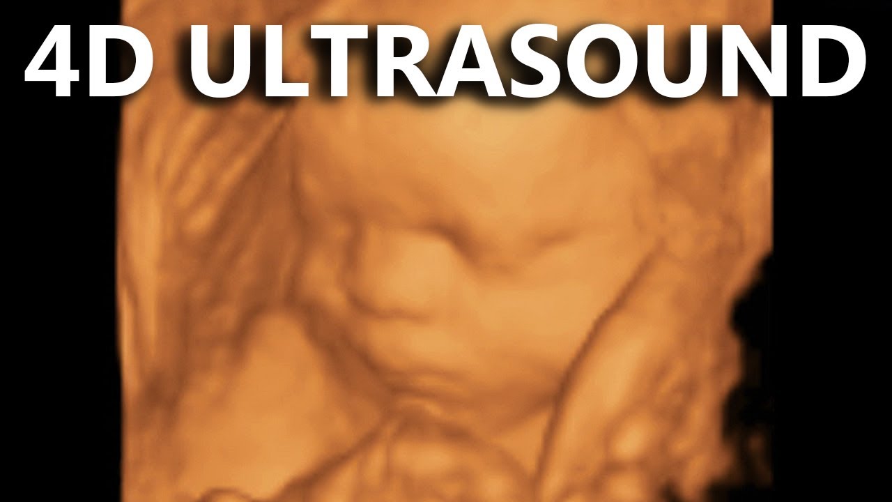 4D Ultrasound | Baby Update | S2: E6 - YouTube