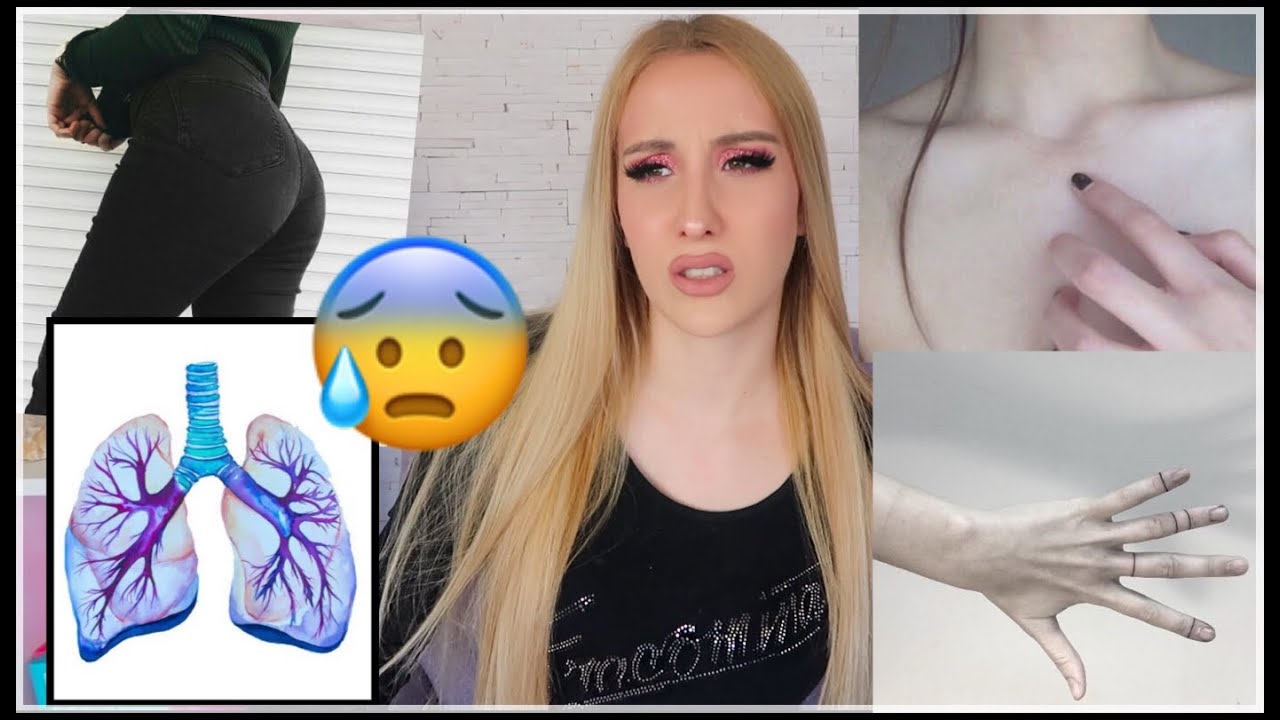 CUDNE STVARI NA MOM TELU 2 - YouTube