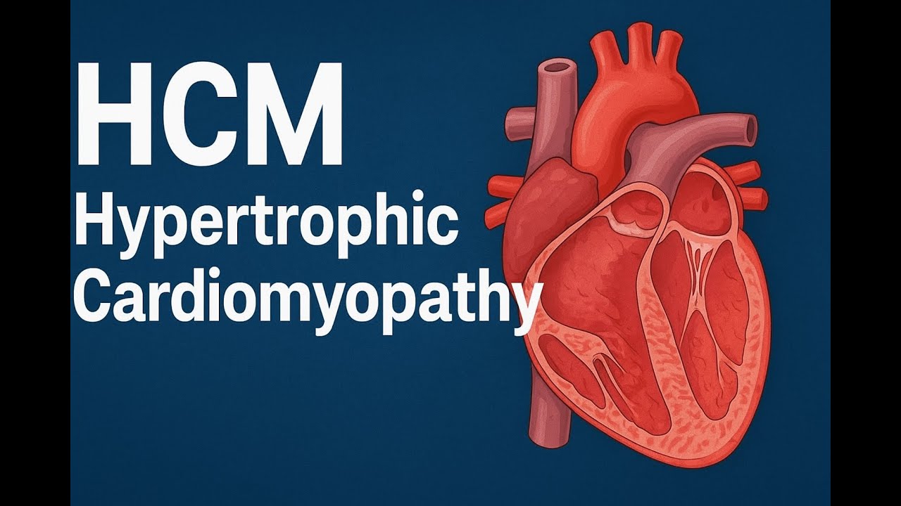 Hypertrophic Cardiomyopathy (HCM & HOCM) Explained | Echo Findings, SAM ...