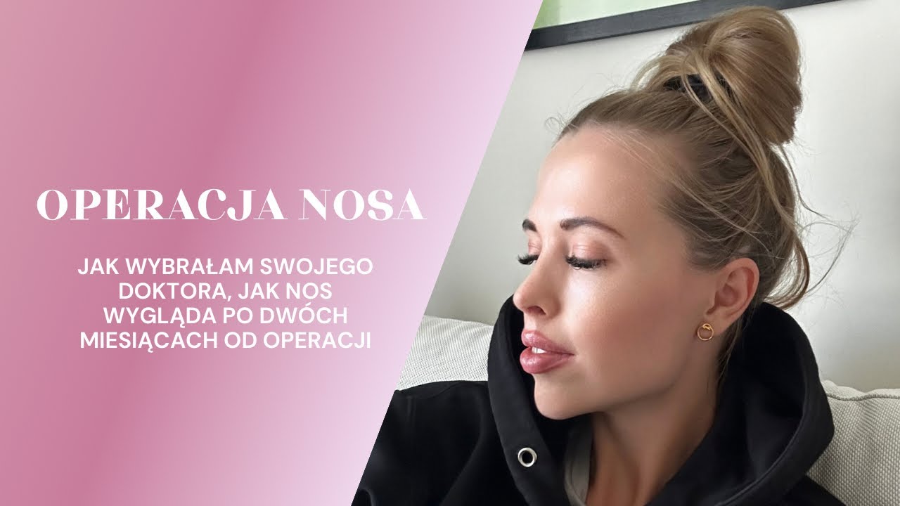 Operacja plastyczna nosa: jak wybrałam swojego lekarza, jak nos wygląda ...