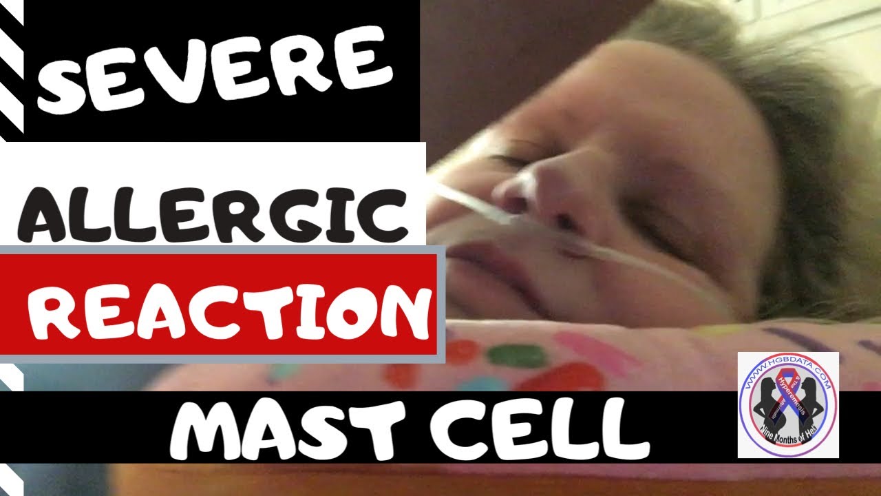 ALLERGIC REACTION | MAST CELL ACTIVATION SY - YouTube