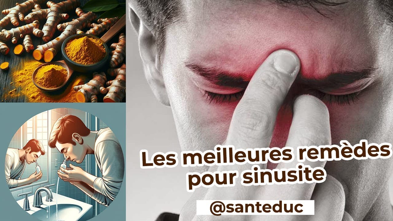 Les meilleurs Remèdes naturels pour Sinusite - YouTube