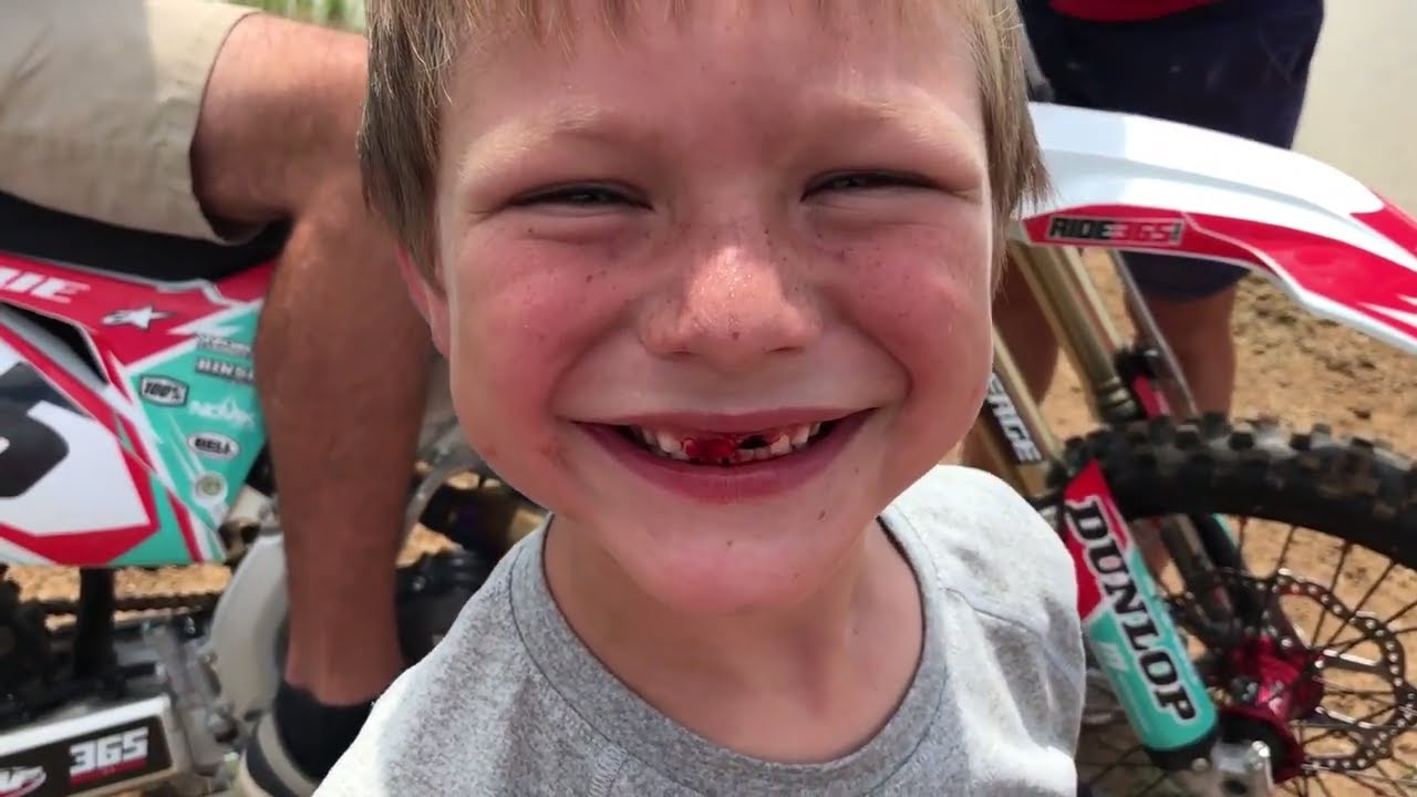 PULLING TEETH W/ A DIRT BIKE!!! - 365 Vlogs w/ Brett Cue - 051 - YouTube