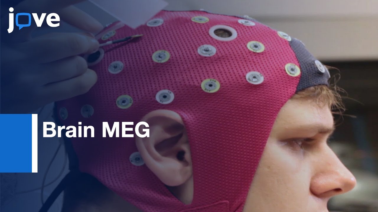 Brain MEG during administration of Xenon and NO | Protocol Preview ...