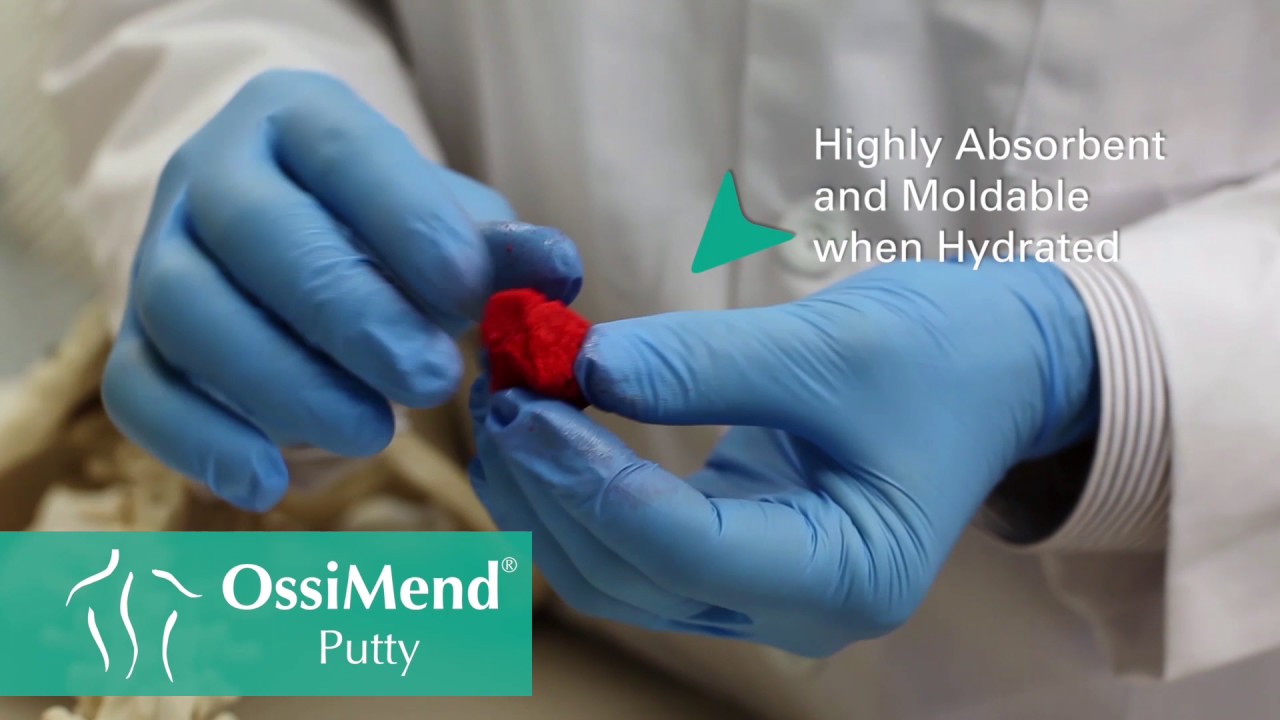 Collagen Matrix - Spine OssiMend® Putty - Product Demo - YouTube