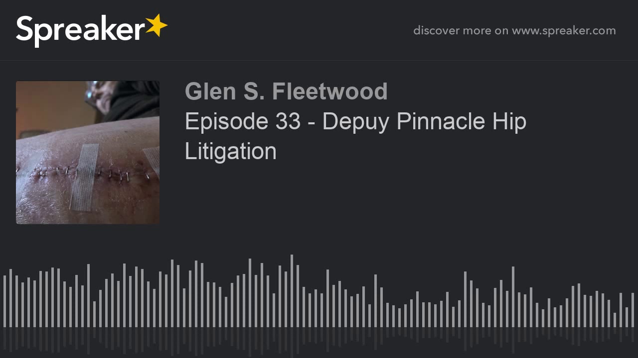 Episode 33 - Depuy Pinnacle Hip Litigation (part 2 of 2) - YouTube
