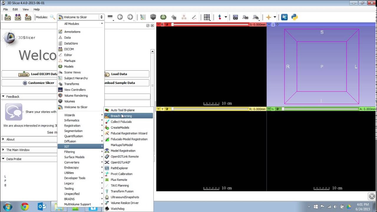 Lets Code 1 Setting Up Python Debugging In Slicer Youtube 5485