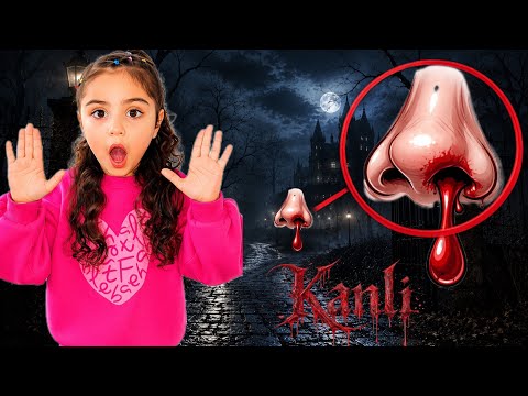 Gece saat 3.00 1 tane kanlı burun evimize geldi