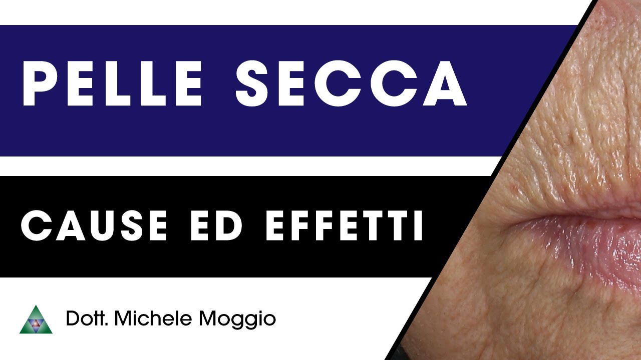 PELLE SECCA CAUSE - YouTube