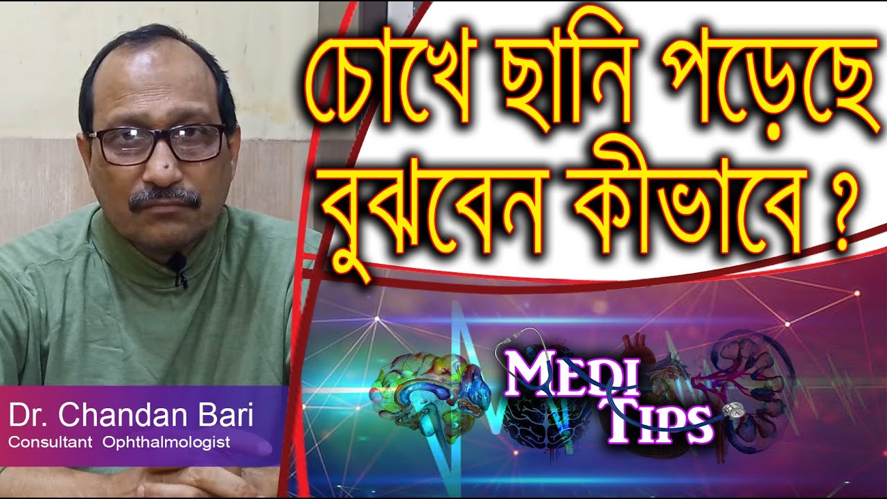 Cataracts - Symptoms and causes || Dr. Chandan Bari || Ophthalmologist ...