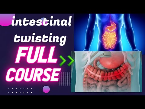 Understanding Intestinal Twisting: A Comprehensive Guide to Diagnosis ...