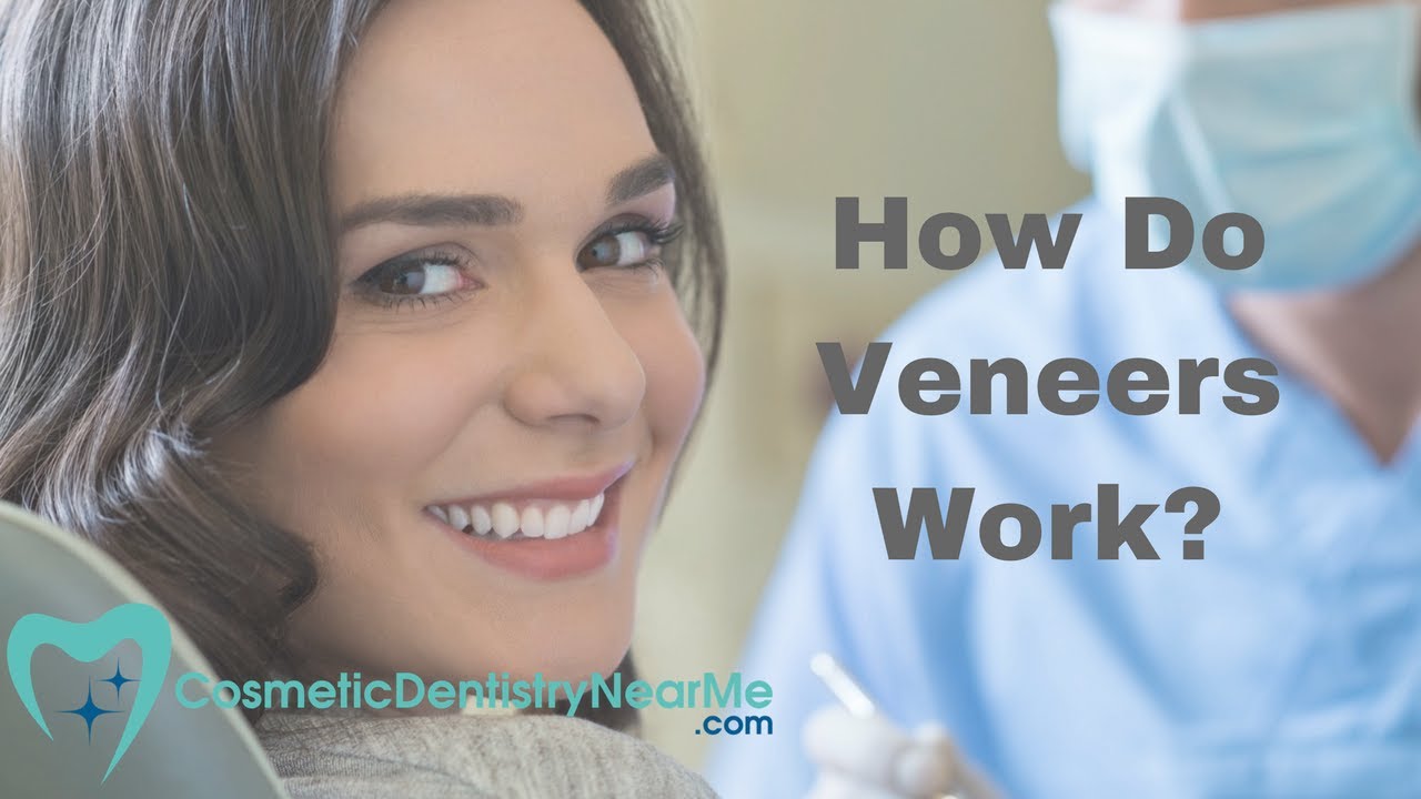 How do Veneers Work? - YouTube