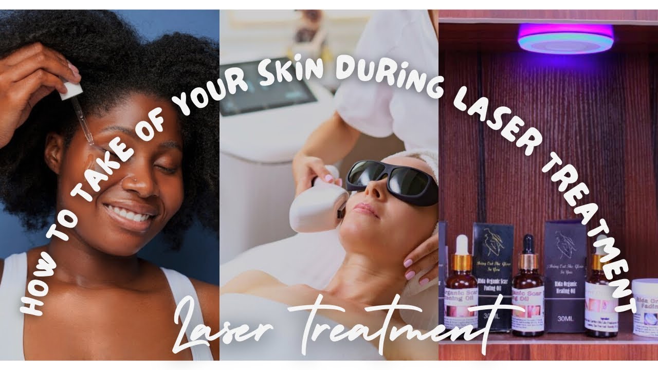 How to take care of your Skin during Laser treatment - YouTube