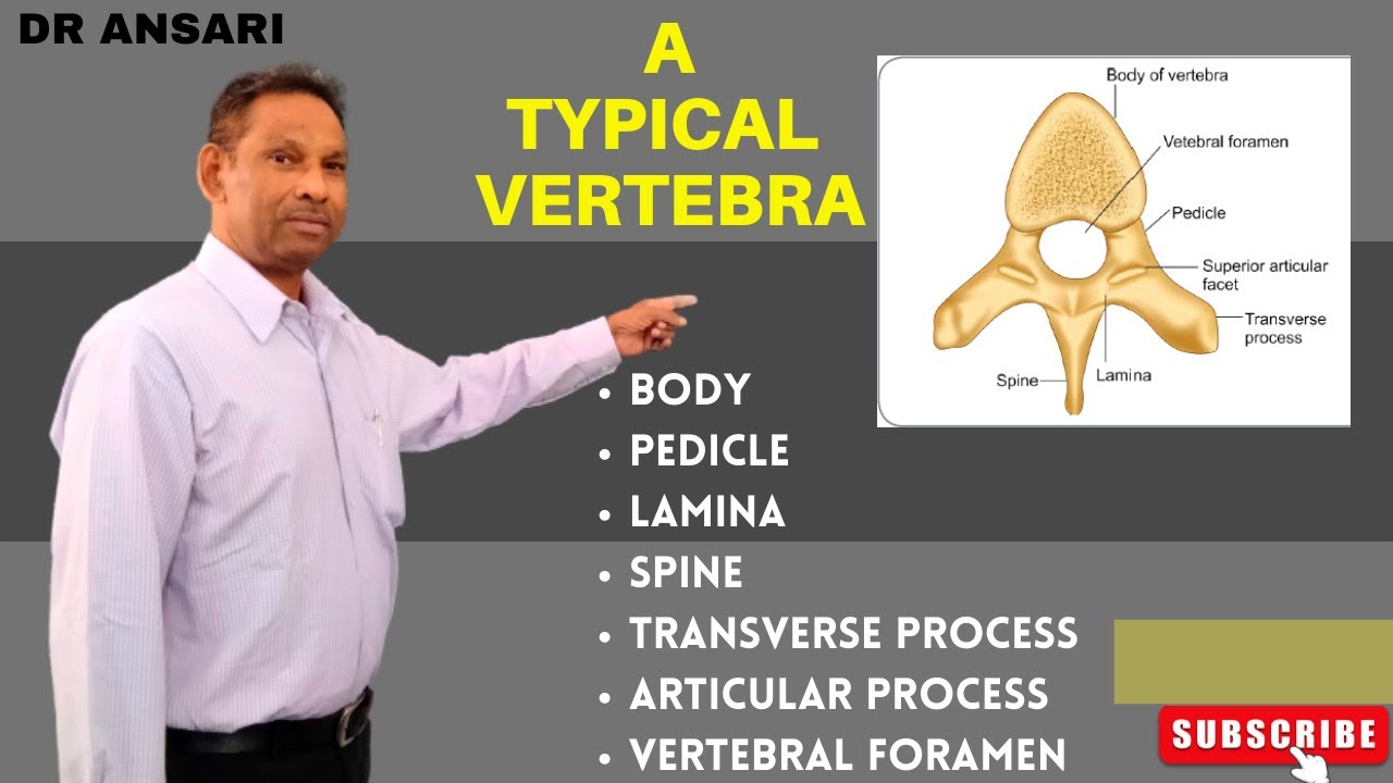 Typical Vertebra | Body | Pedicle | Transverse process | Lamina ...