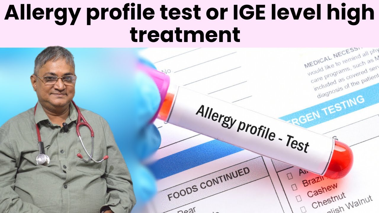 Allergy Test & High IgE Treatment - YouTube