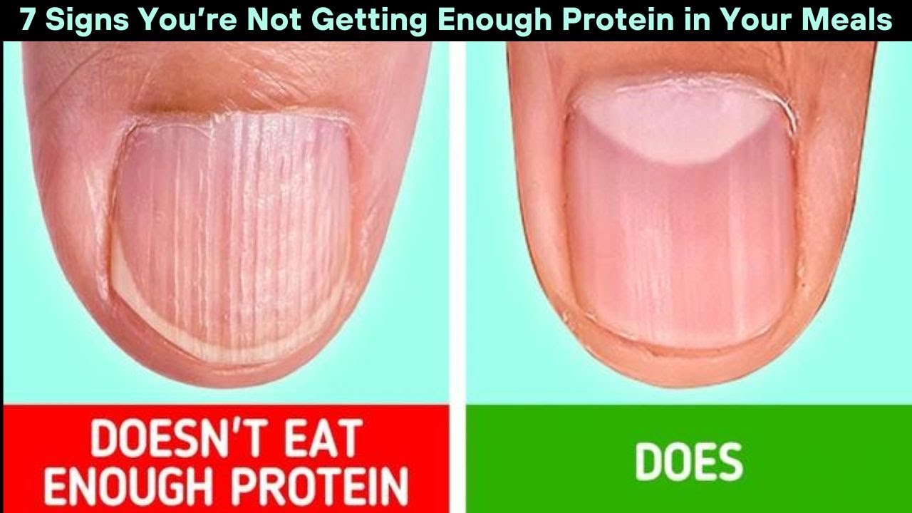 7 Signs You’re Not Getting Enough Protein in Your Meals | How To Video ...