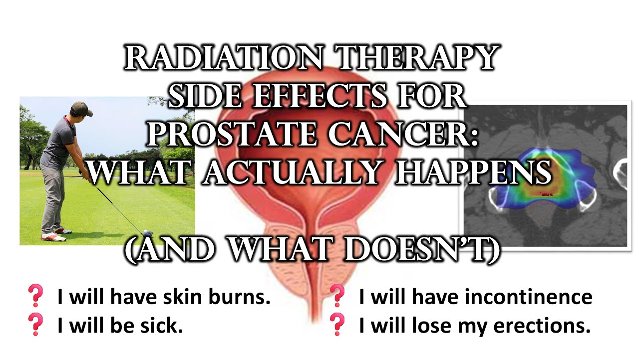 Radiation Therapy Side Effects for Prostate Cancer: What Actually ...