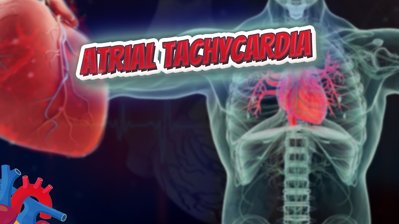 Atrial tachycardia (Human Heart ️ & Cardiology) ️🔊 - YouTube