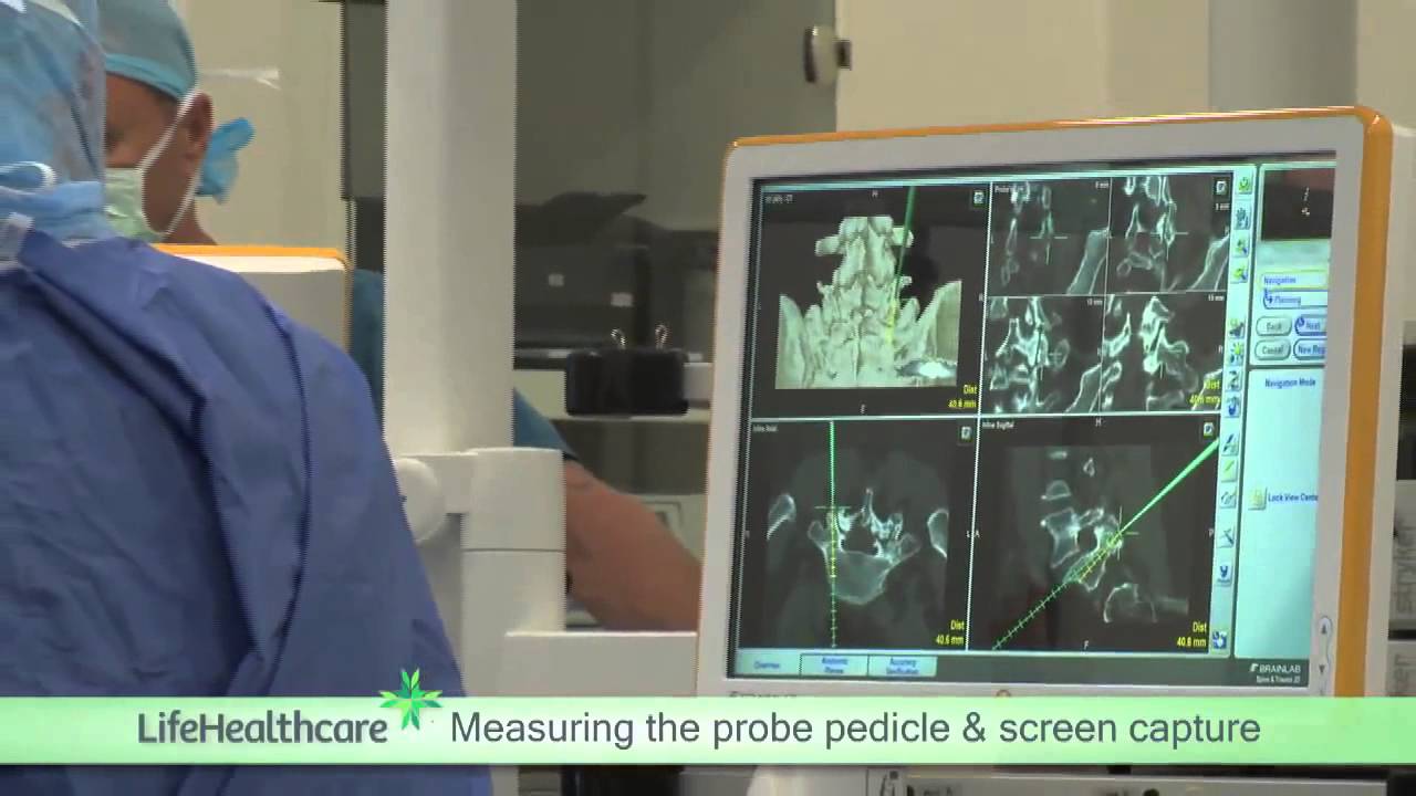BodyTom Portable CT - How it Works - YouTube