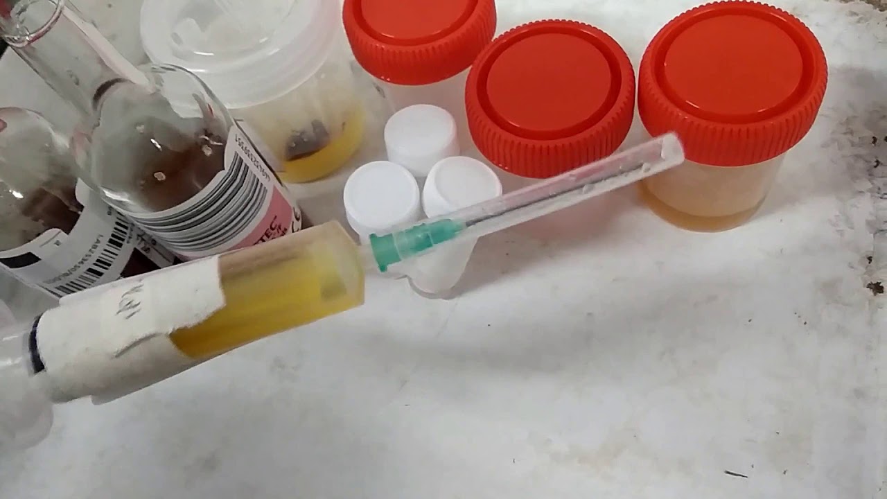 various samples, their appropriate containers and common culture media ...