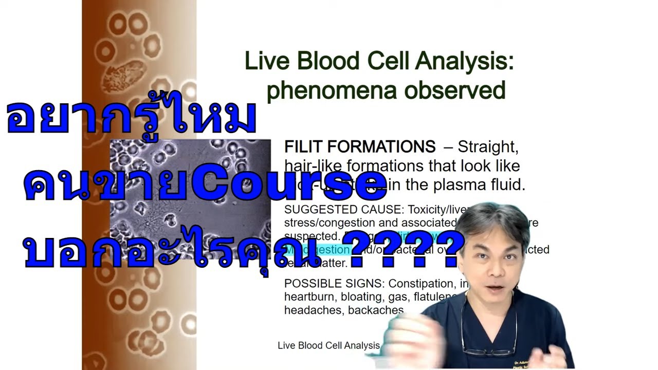 เรียนรู้จากข่าว : หมอแล็บเตือน Live Blood Analysis ทำไมต้องหนี ...