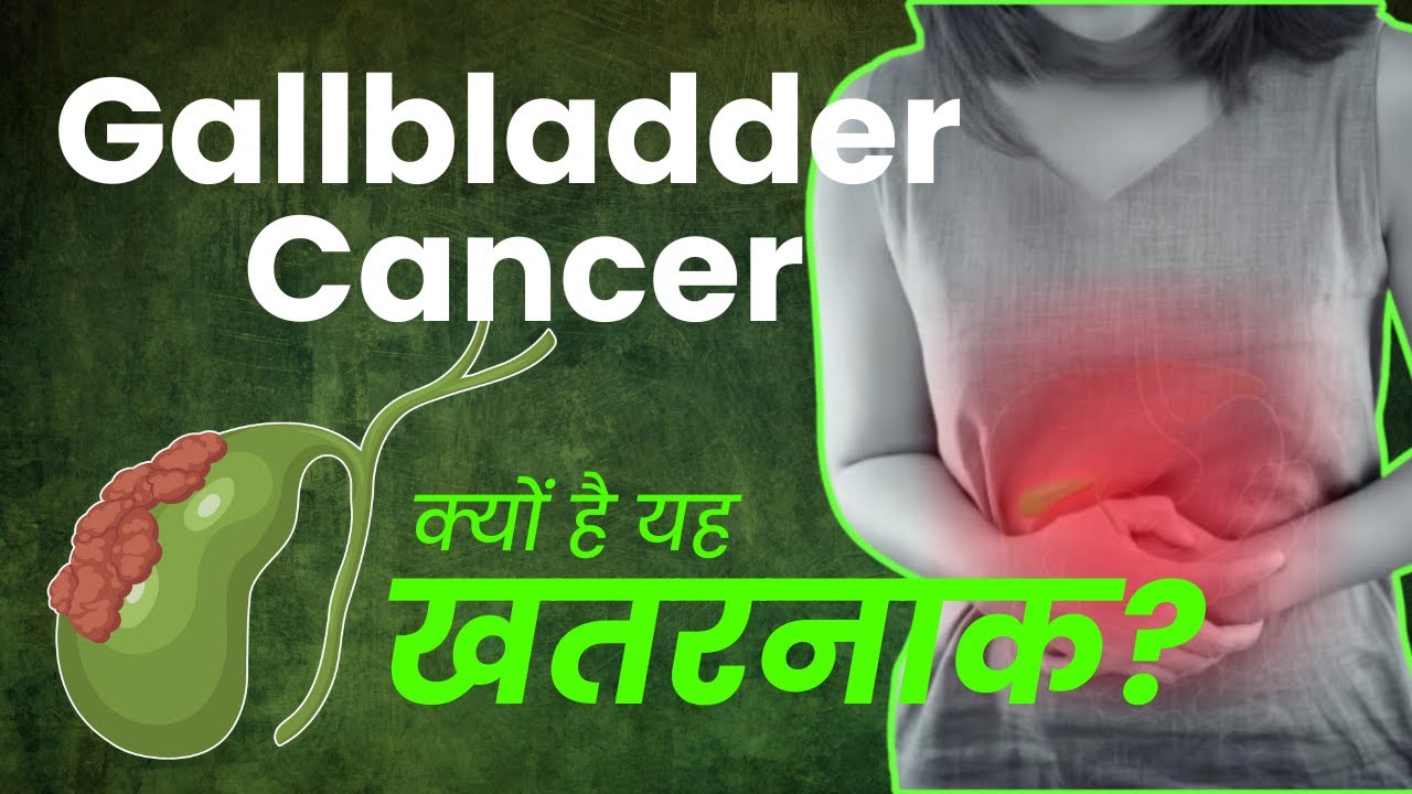 Health Facts: What is Gallbladder Cancer, Know Symptoms, Causes ...