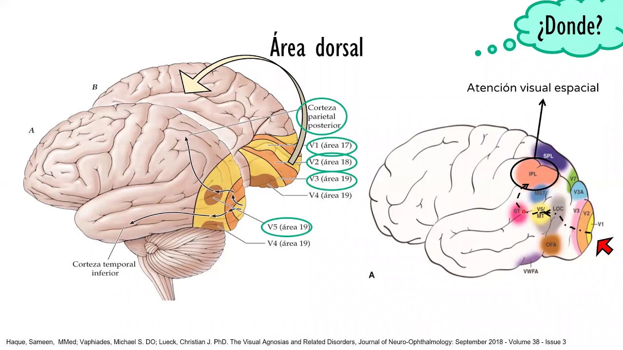 Agnosias visuales - YouTube