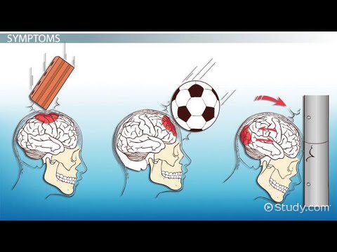 blunt force trauma to the head - YouTube