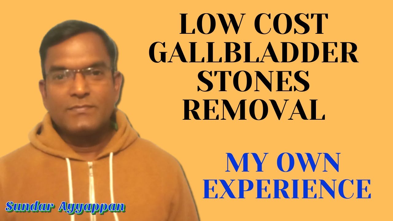 Gallbladder stones treatment in tamil | பித்தப்பை கற்கள் வைத்தியம் ...