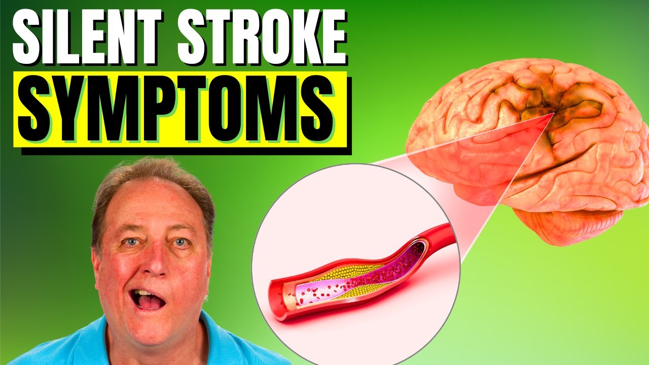 9 Silent Stroke Signs You Should Never Ignore! - YouTube