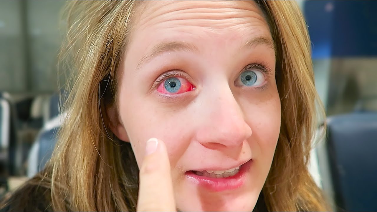 CONTRACTED A DISEASE! - YouTube