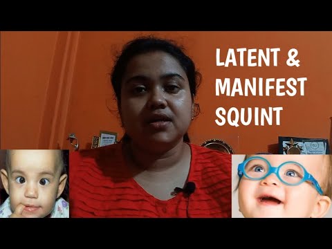 What is a latent and Manifest Squint? | An educational video - YouTube