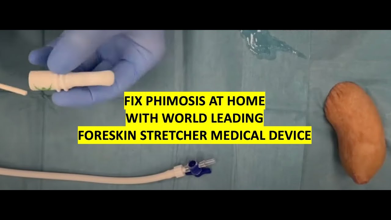 Easily Apply The Novoglan Phimosis Treatment Device - YouTube