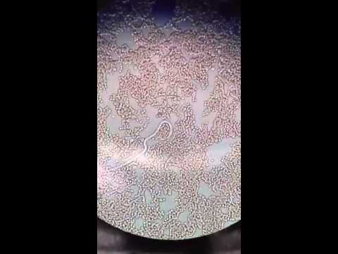 Direct smear heart worm. - YouTube