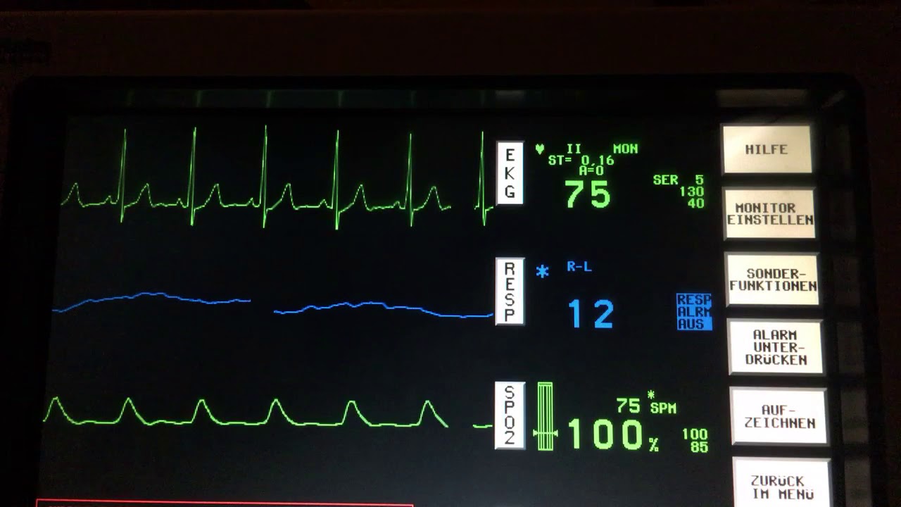 New ECG Video in the Night - YouTube