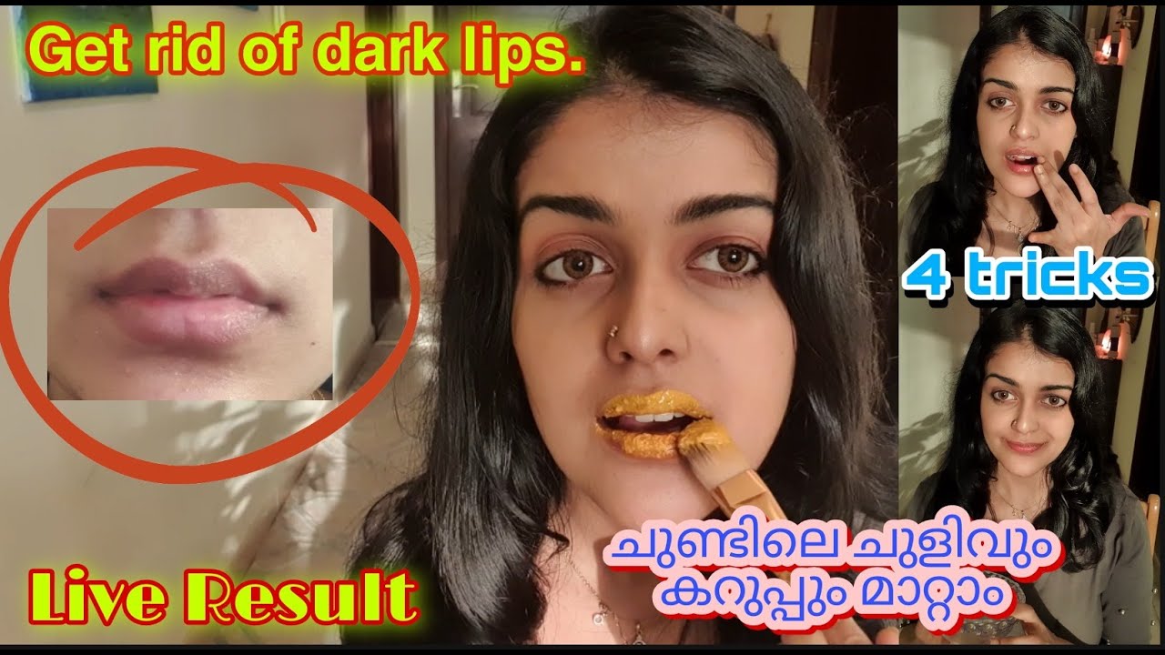 How I get rid of my pigmented, dark lips| lip care routine| live result ...