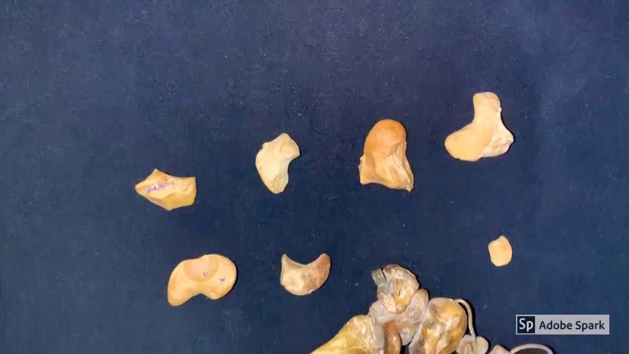 IDENTIFICATION OF CARPAL BONES - YouTube