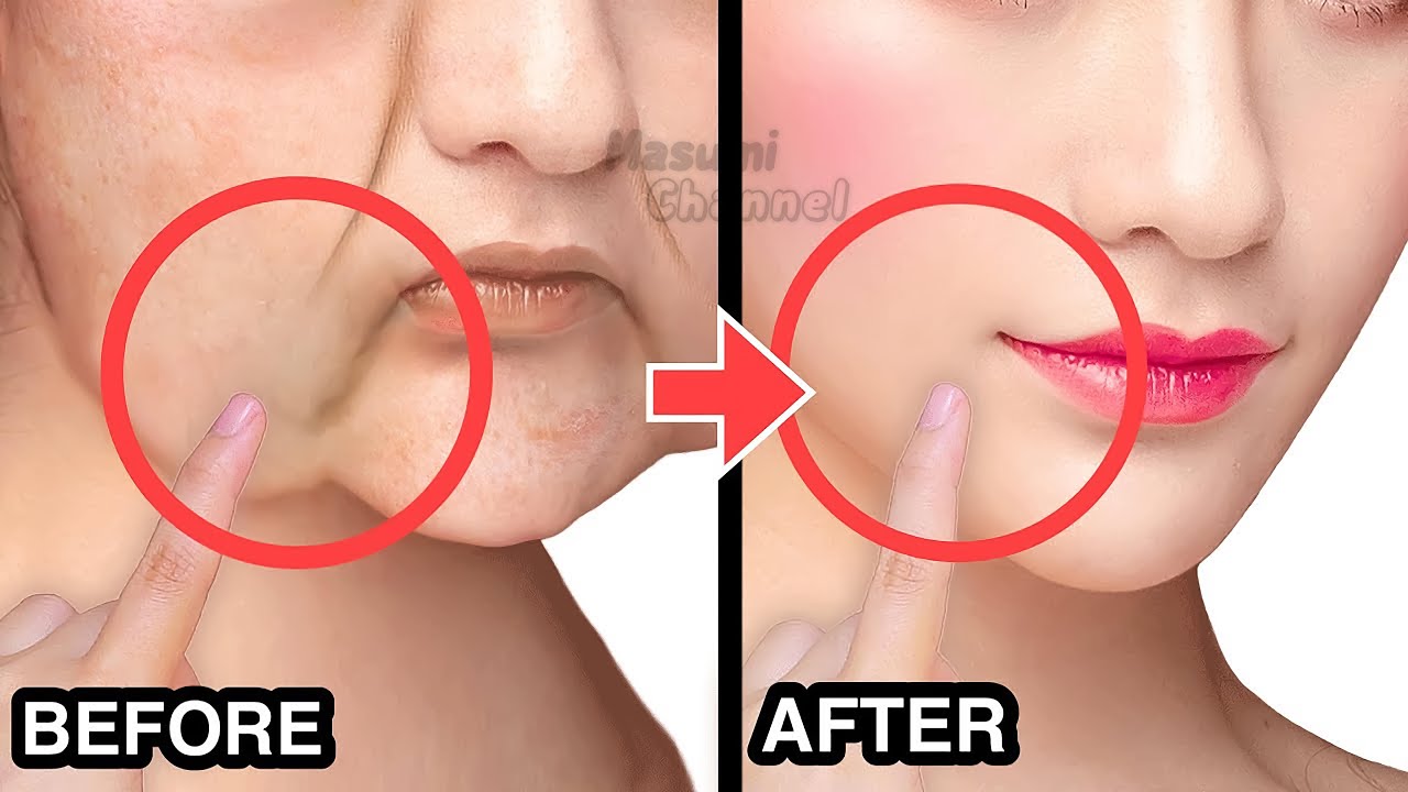 9mins Anti Aging Face Massage For Droopy Mouth Corners Sagging Jowl