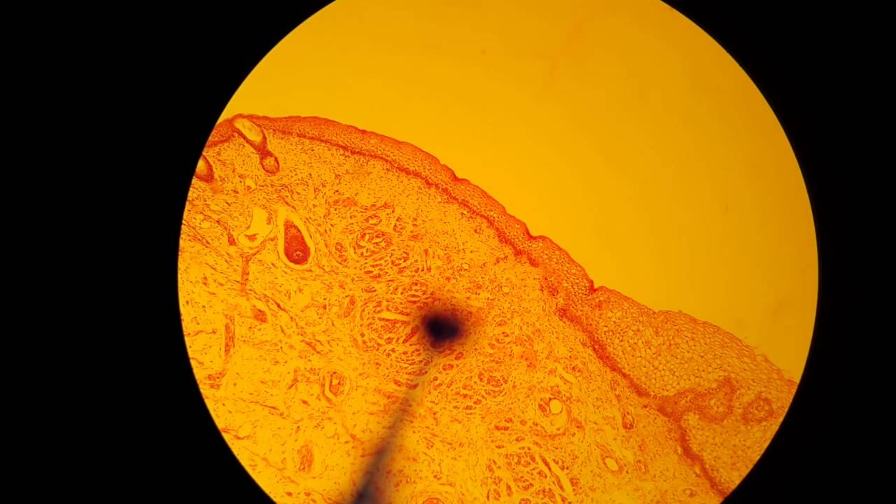 histology of the Lips - YouTube