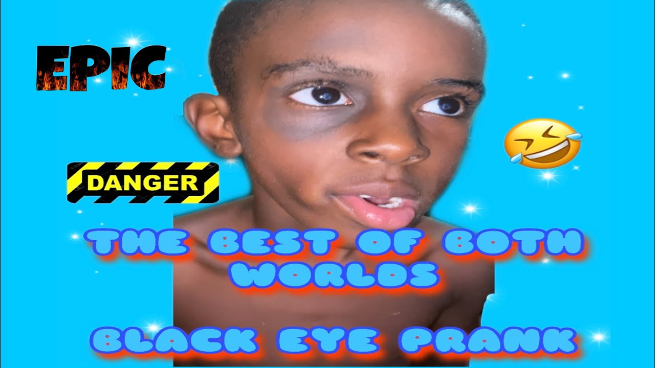 Black eye prank 2020 - BEST OF BOTH WORLDS - YouTube